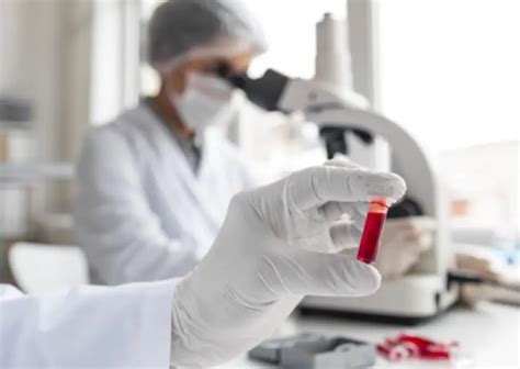 Hematocrit Test Normal Range Purpose Procedure And Results