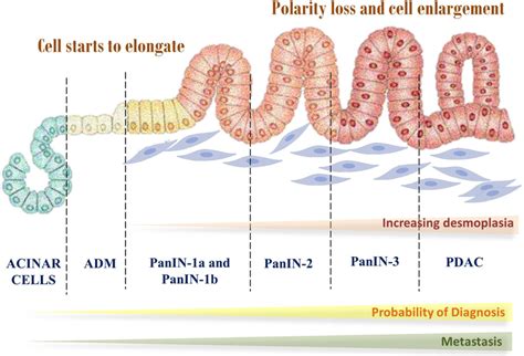 Development And Progression Of The Pancreatic Cancer Download