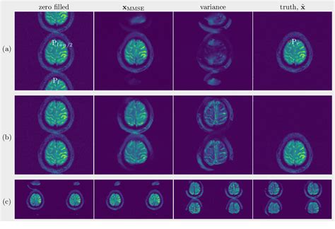 Figure 3 From Mri Reconstruction Via Data Driven Markov Chain With