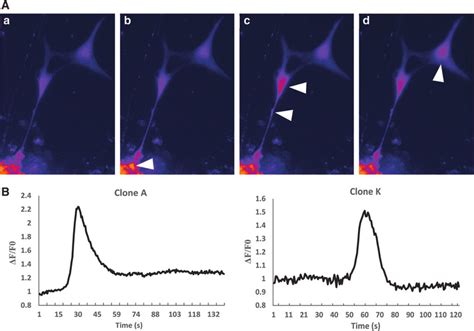 Spontaneous Neuronal Activity In Equipsc Derived Neurons A Selected