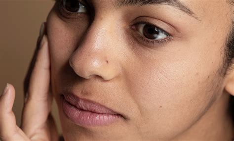 Can Laser Hair Removal Worsen Hyperpigmentation London Premier Laser