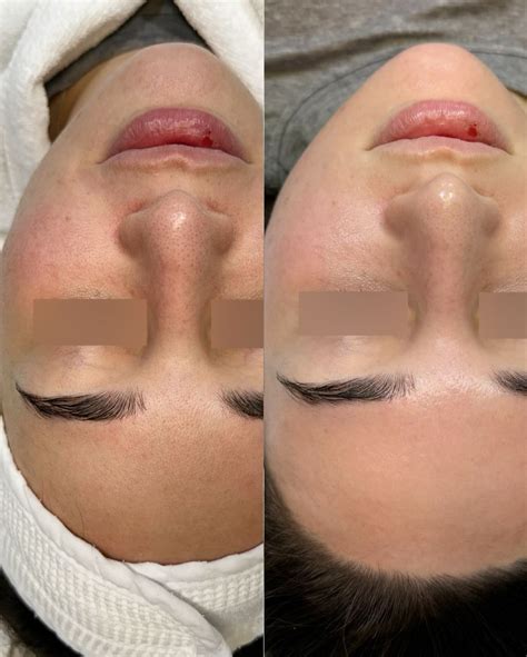 Косметолог Массаж лица Обучение Москва Mariaya Frolova массаж массажлица