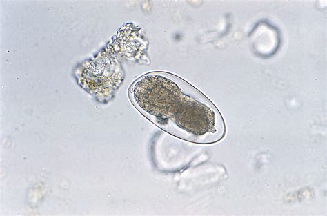 Public Domain Picture Egg Of Trichostrongylus Id 13523557218563