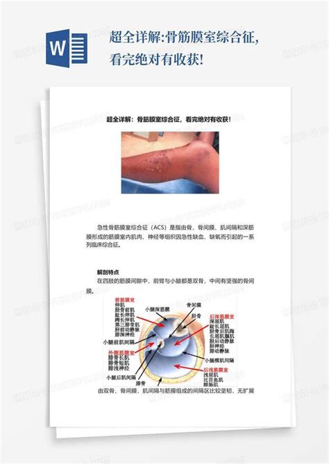 超全详解骨筋膜室综合征看完绝对有收获word模板下载编号lebwzmdg熊猫办公