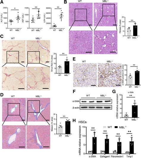 Mannan Binding Lectin Via Interaction With Cell Surface Calreticulin Promotes Senescence Of