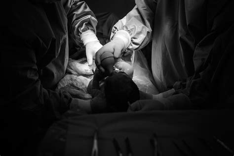 Premium Photo Cesarean Section The Operation Is In Process