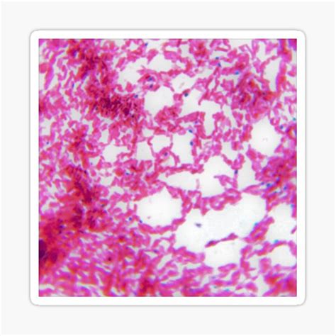 Bacillus Cereus Endospore Stain Sticker For Sale By Amethystinum
