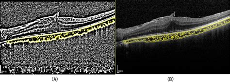 image binarization a tca was selected and the image was adjusted by download scientific
