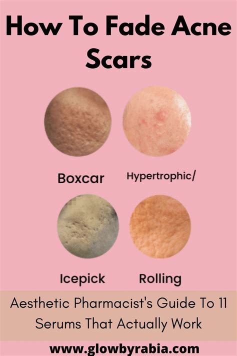 How To Fade Acne Scars Artofit