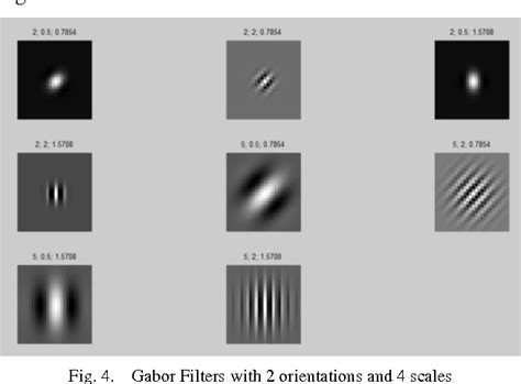 Figure 4 From Hybrid Texture Based Classification Of Breast Mammograms Using Adaboost Classifier