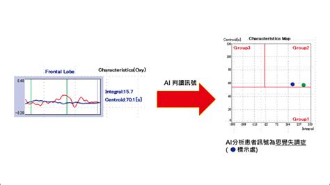 Ai判讀腦波 輔助醫師精準評估憂鬱症 自由健康網