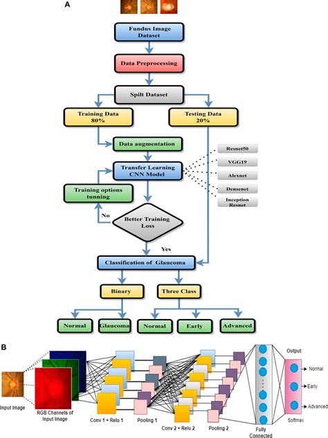 Frontiers Multi Stage Glaucoma Classification Using Pre Trained Convolutional Neural Networks
