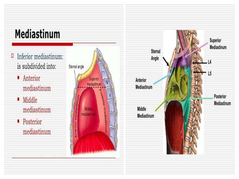 Mediastinal Anatomy Classification Of Mediastinal Masses Ans Its Loc
