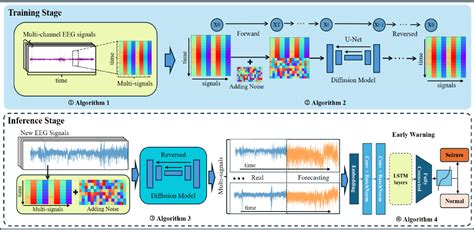 논문 리뷰 Eeg Dif Early Warning Of Epileptic Seizures Through Generative Diffusion Model Based