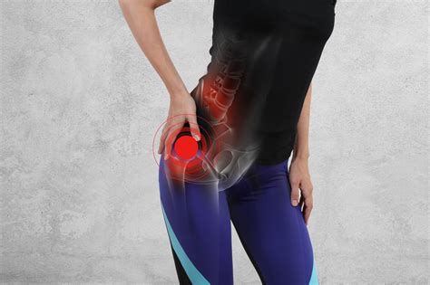 Hip Arthrogram With Anesthesia Su Spine And Sports