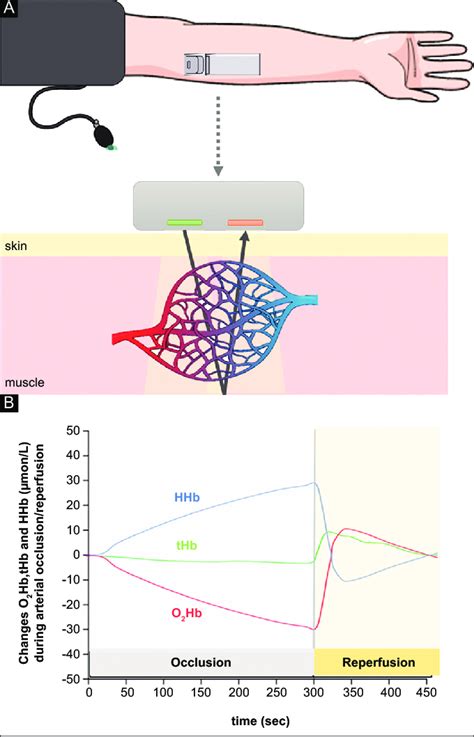 Evaluation Of Muscle Oxygenation Via Near Infrared Spectroscopy Nirs Download Scientific