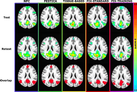 Single Subject Dmn Example Reconstructed Dmn Map After Dual Regression Download Scientific Single Subject Dmn Example Reconstructed Dmn Map After Dual Regression Download Scientific