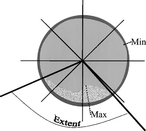 Schematic Depiction Of An Aortic Short Axis Slice With Atherosclerotic Download Scientific