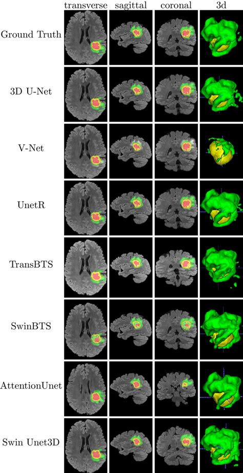 The Segmentation Results Of Each Model Were Visualized On The