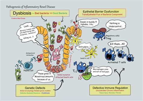 Inflammatory Bowel Disease Ibd Pathogenesis Creative Med Doses