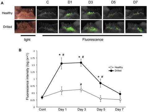 Bisphosphonate Uptake In Areas Of Tooth Extraction Or Periapical Disease Pmc
