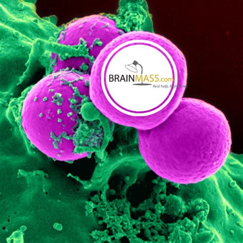 Brainmass Website 3468 Photos Facebook