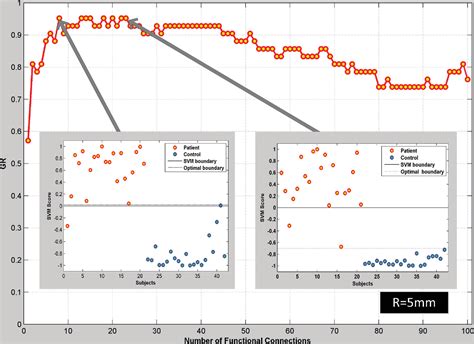 Figure 1 From Mesial Temporal Lobe Epilepsy Lateralization Of Functional Connectivity In