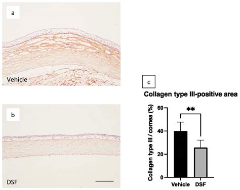 Disulfiram Ophthalmic Solution Inhibited Macrophage Infiltration By Suppressing Macrophage