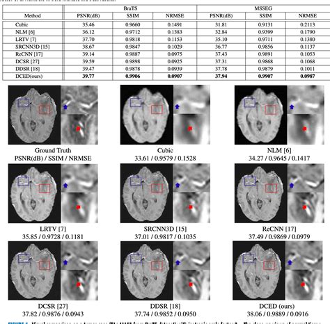 Figure 6 From Brain Mri Super Resolution Using 3d Dilated Convolutional
