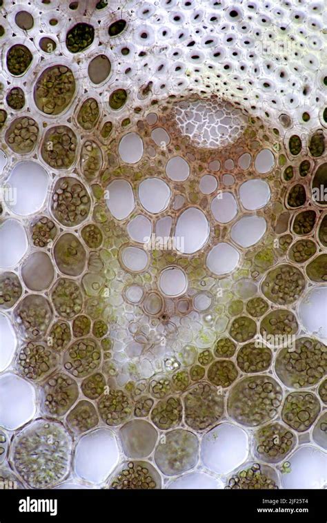 Bright Field Light Micrograph Of A Transverse Cross Section Through A Vascular Bundle In