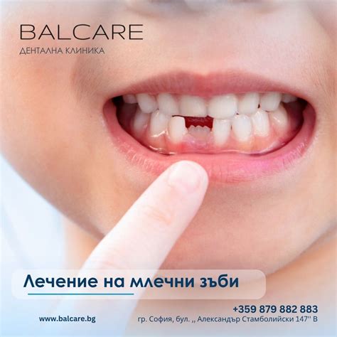 Лечение на млечни зъби защо е толкова важно Дентална Клиника Balcare