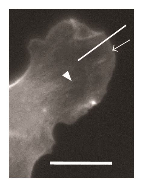 Effect Of The Inhibitors Of Actin Turnover Or Those Of Myosin Ii