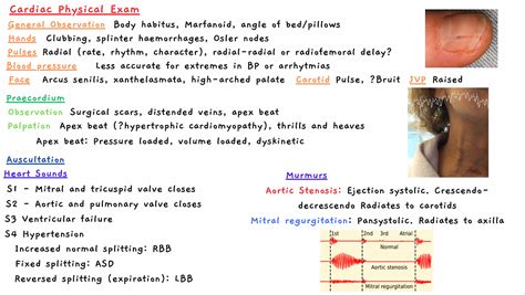 Cardiovascular Physical Examination