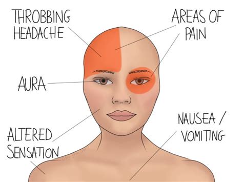 Symptoms And Management Of Migraines Through Osteopathy The Carlton Clinic