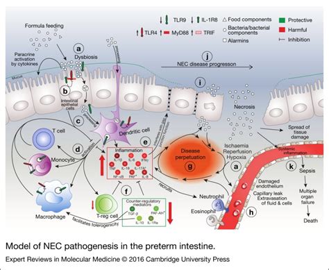The Immunological Landscape In Necrotising Enterocolitis Pmc