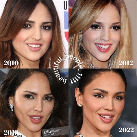 Eiza Gonzalez Plastic Surgery Before And After Celebrity Eiza Gonzalez