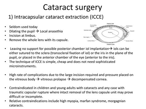 Cataract Surgerypptx
