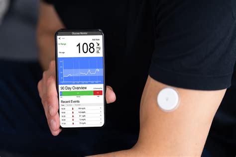 Should I Use Continuous Glucose Monitoring Cgm Cgm 101 Patientsengage