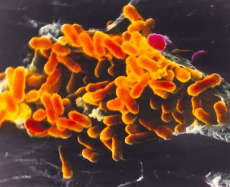 50 Facts About Typhus