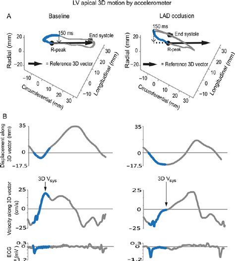 A Automatic Calculation Of Accelerometer 3d V Sys Accelerometer