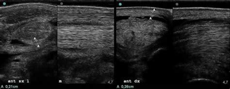 Diagnostics Ultrasound Equine Practice