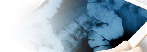 Periop 06 Study Qu Biologics