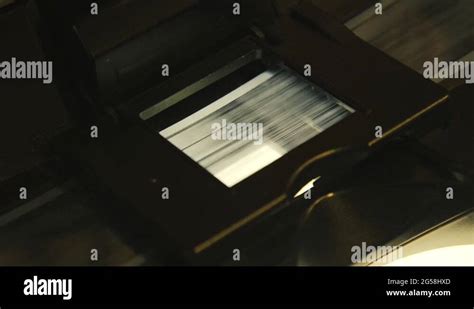 Micro Operation Stock Videos Footage HD And 4K Video Clips Alamy