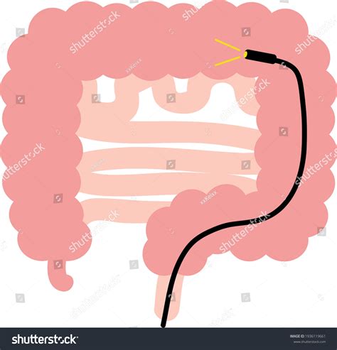 Colonoscopy Scope Over 14 Royalty Free Licensable Stock Illustrations