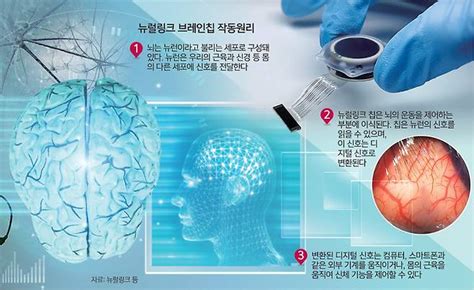 인간의 로봇화… 머스크의 ‘뉴럴링크 혁신인가 사기인가 [미드나잇 이슈]