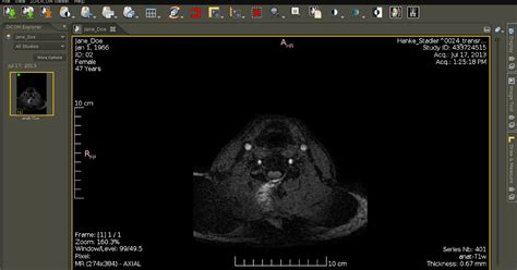 Read The Dicom Image Metadata Using Java Learntocode