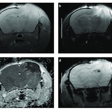 Demonstrating Main Radiological Features Of Decompressive Craniectomy Download Scientific