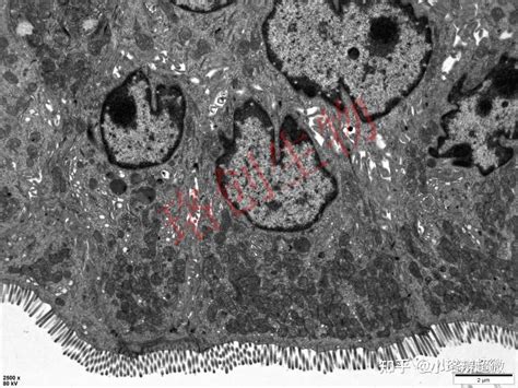 第二十六期：透射电镜下的肠上皮 知乎