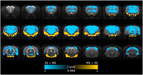 Spatial Distribution Of Tsnr Ms Epi Shows Reduced Temporal Snr In Download Scientific Diagram