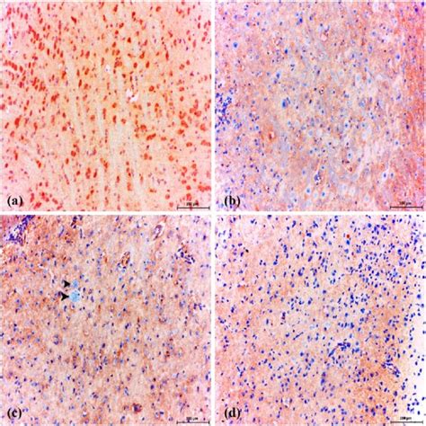 Histopathology Of Te A Toxoplasma Gondii Tissue Cysts Arrow And